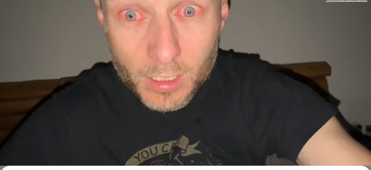 Beim Schweißen die Augen verblitzt was tun? 1 paar Tipps